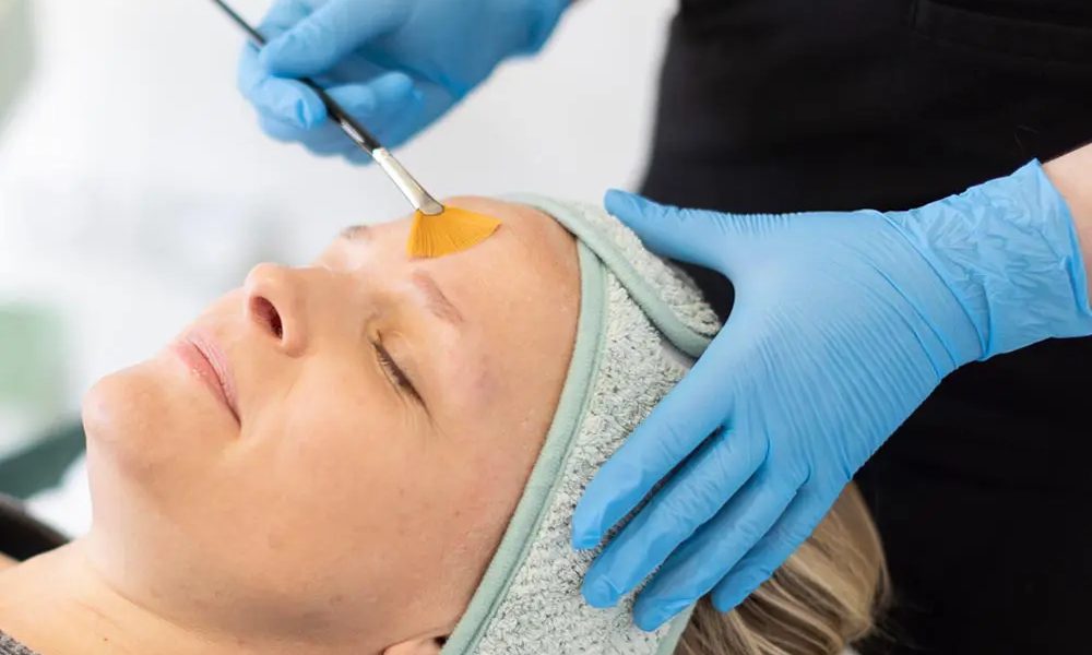 A Beginner’s Guide to Skin Peel Treatments